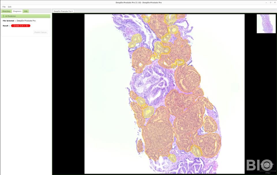 Aiming for No. 1 in prostate cancer… What makes DeepBio's AI software so special?