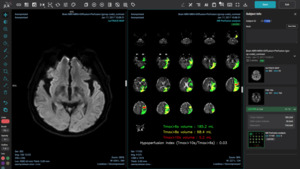 제이엘케이, 뇌졸중 솔루션 ‘JLK-PWI’ 올해 2번째 日 PMDA 허가